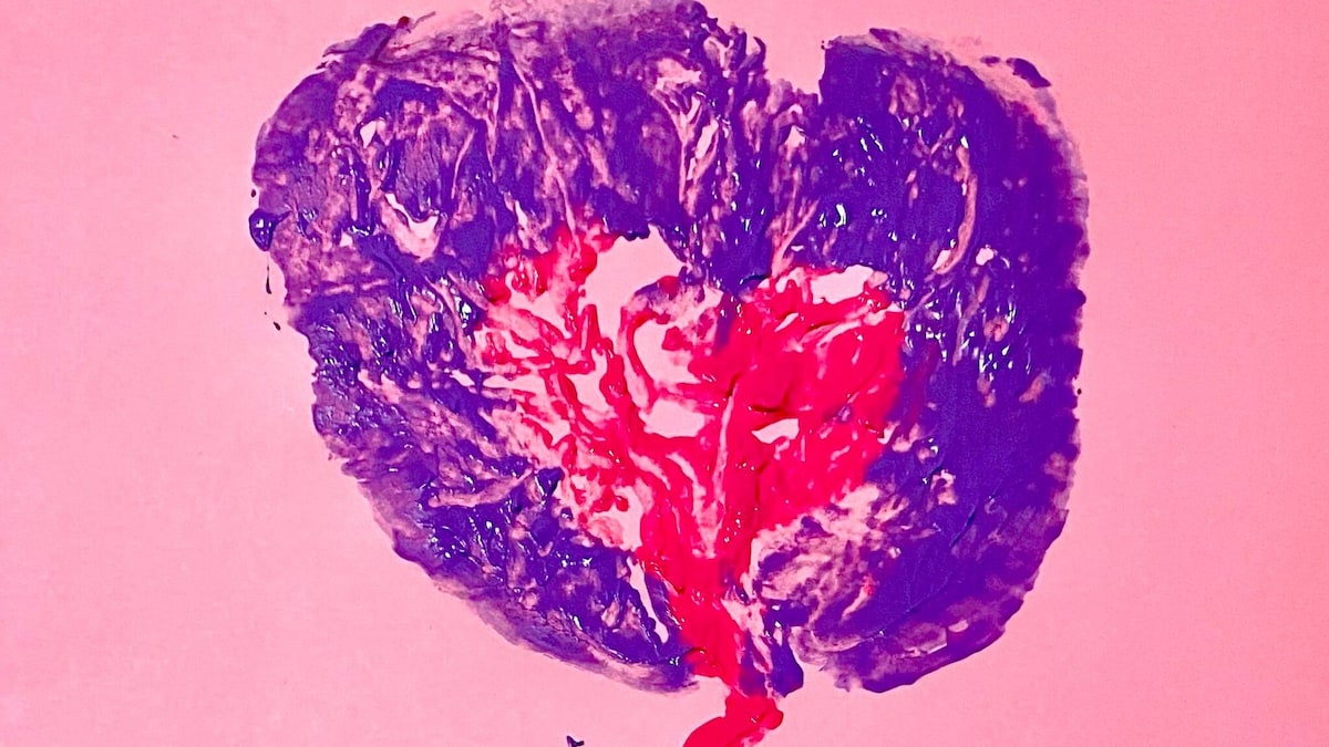 La impresión de placenta, ¿qué es y cómo se lleva a cabo?