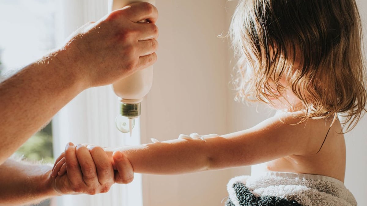 Dermatitis atópica en niños: estas son sus causas y así se puede prevenir