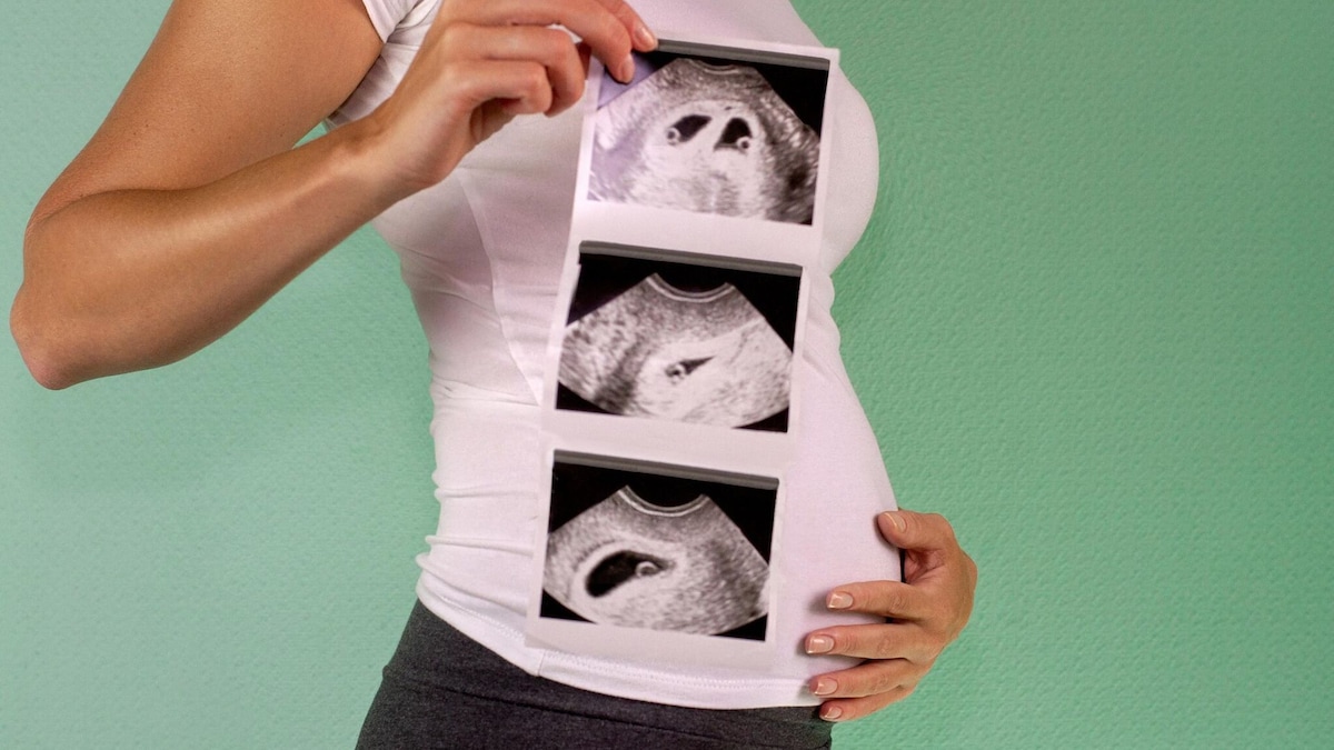 Síndrome del gemelo evanescente: ¿en qué consiste?