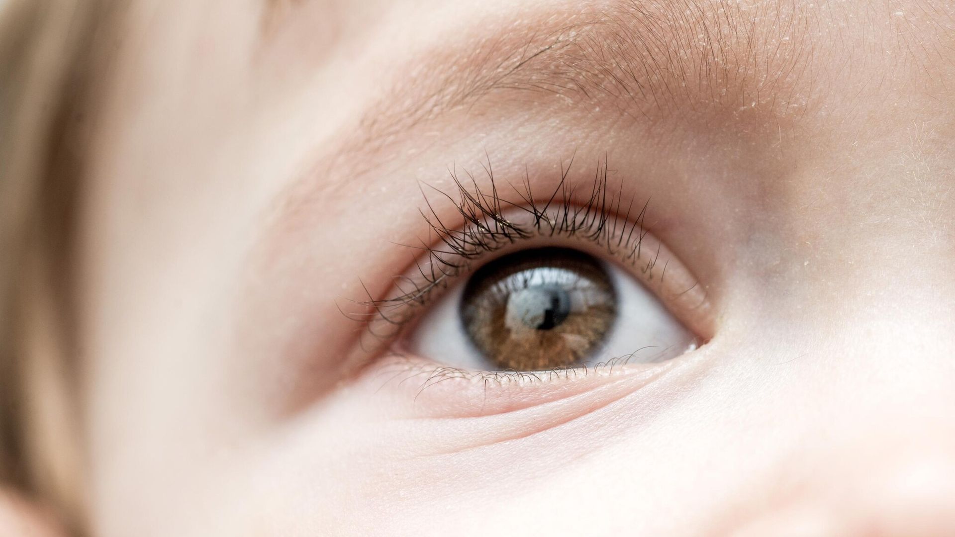 Cómo se detecta y se trata el glaucoma infantil