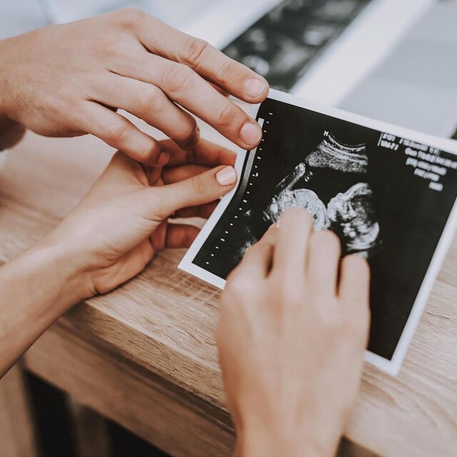 Tipos de placenta en un embarazo