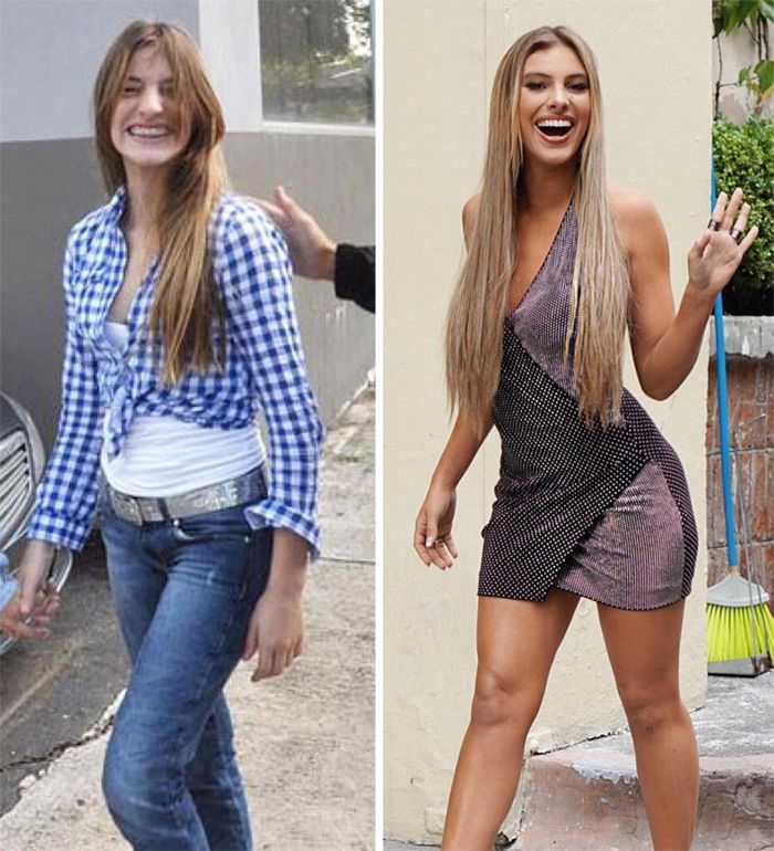 Lele Pons muestra el antes y el después de sus retoques