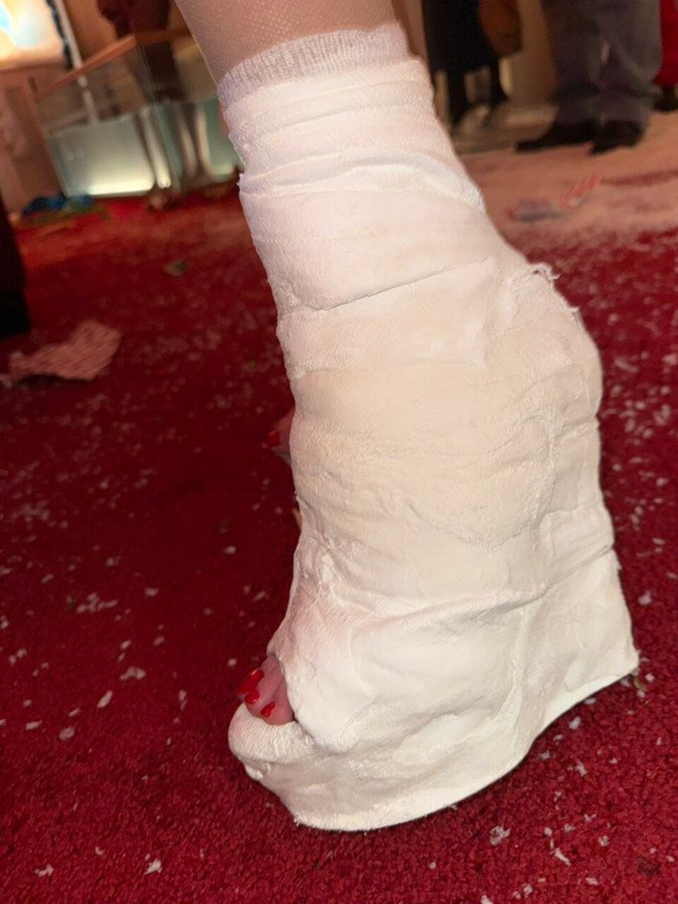 Kim Kardashian causa revuelo con su glamoroso yeso en forma de tacón ...