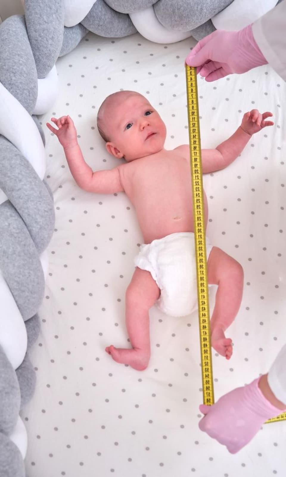 Macrocefalia: cuáles son las causas y cómo se detecta