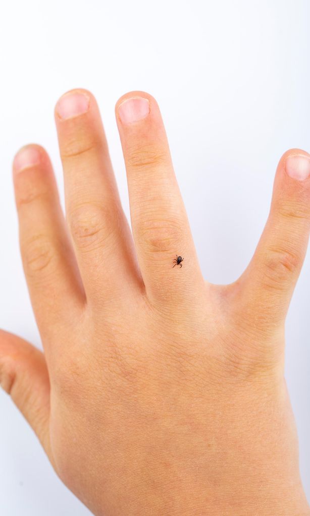 Picadura de garrapata en niños: cómo actuar