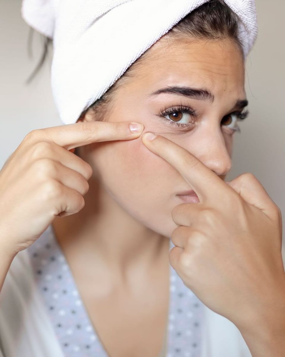 Qué son los miliums y cómo pueden eliminarse