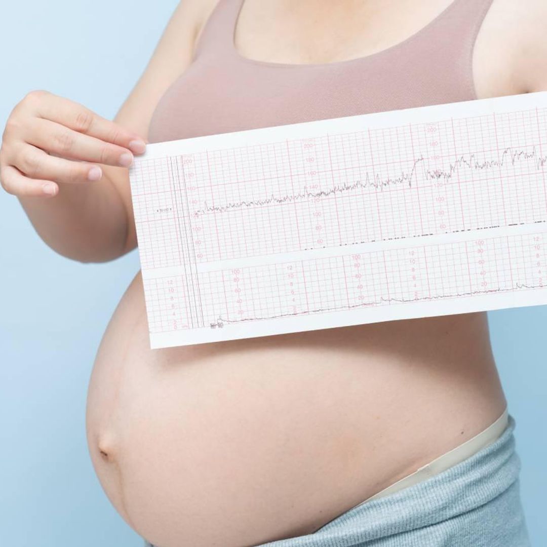 Monitorización fetal en la semana 41 del embarazo