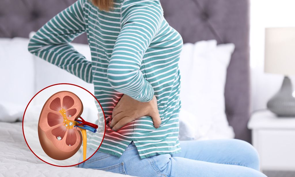 Nefritis: ¿por qué se inflaman los riñones?