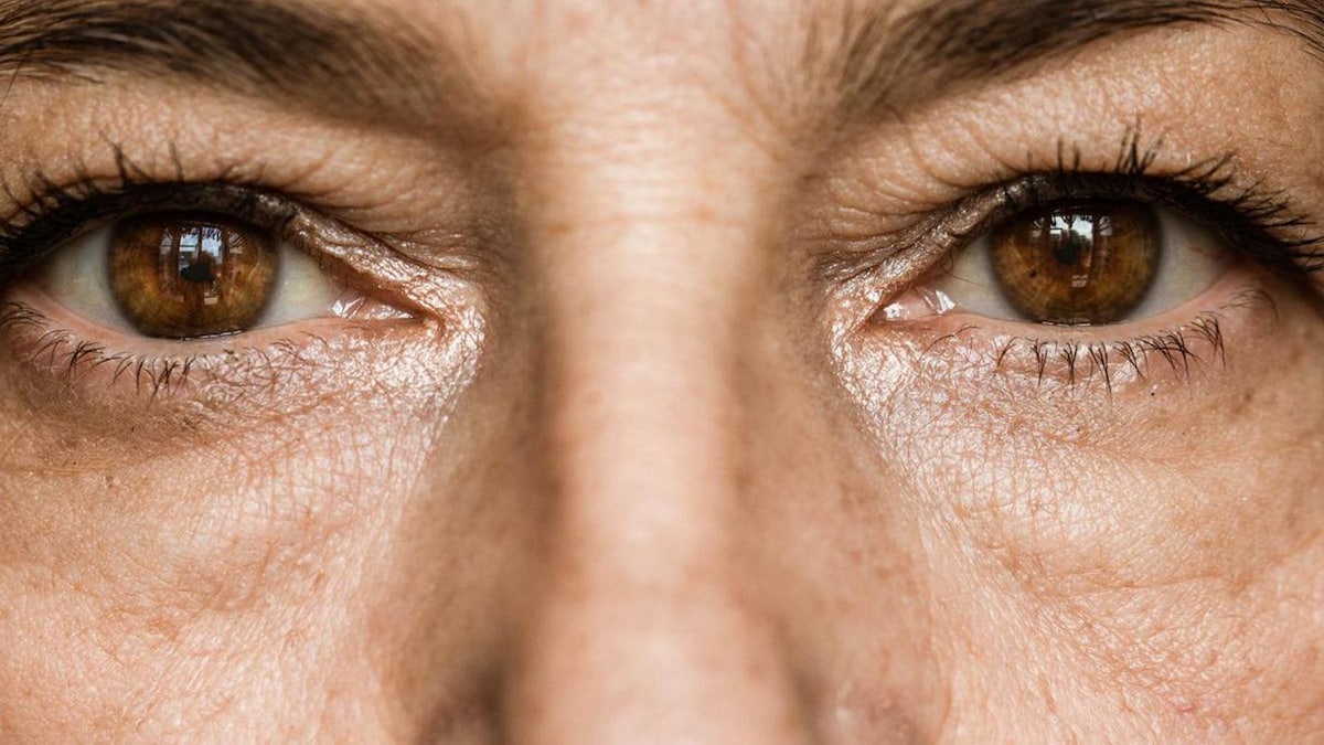 What is Estrogen Deficient Skin?