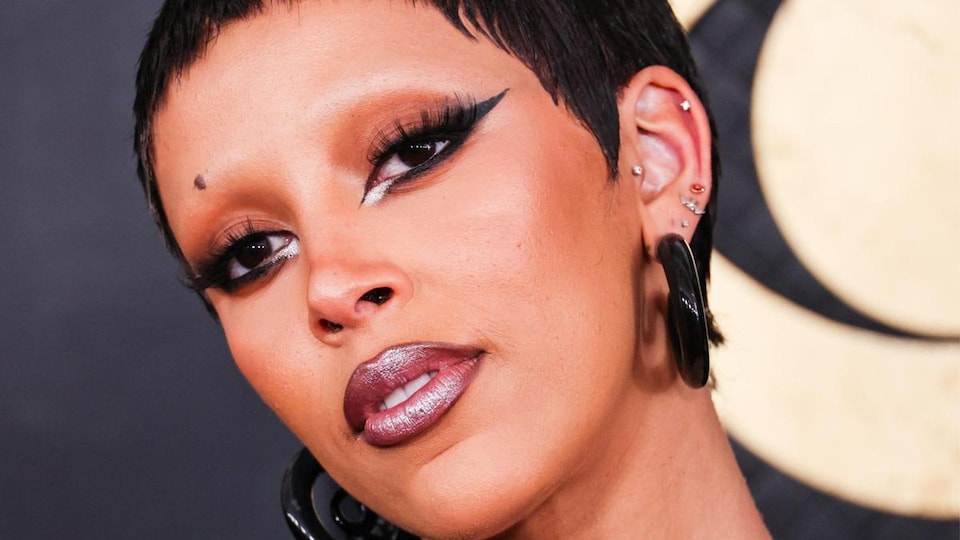 Doja Cat reveals she had plastic surgery and is recovering