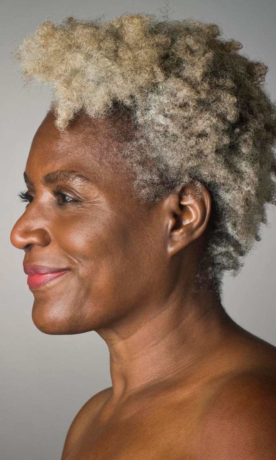 What is Estrogen Deficient Skin?