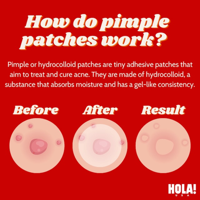 How do pimple patches work?